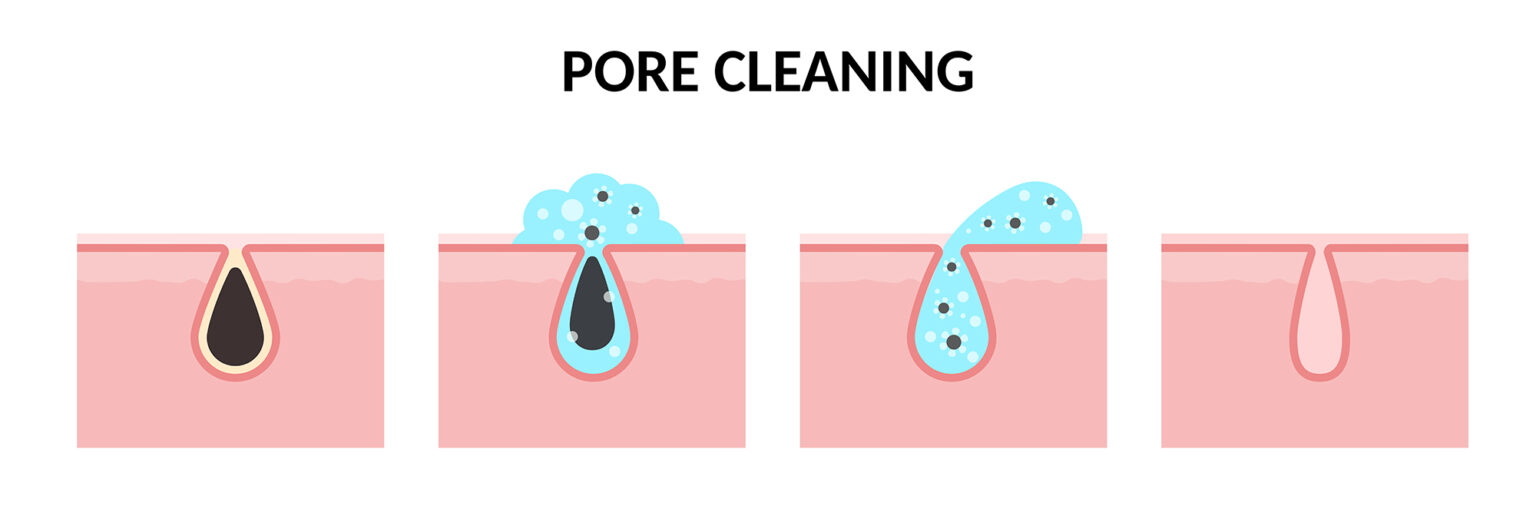 Deep Pore Facial in Miami, Florida | Solea Brickell SPA